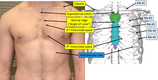 Proper Electrocardiogram (ECG/EKG) Lead Placement | ECGEDU