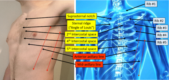 Proper Electrocardiogram (ECG/EKG) Lead Placement | ECGEDU