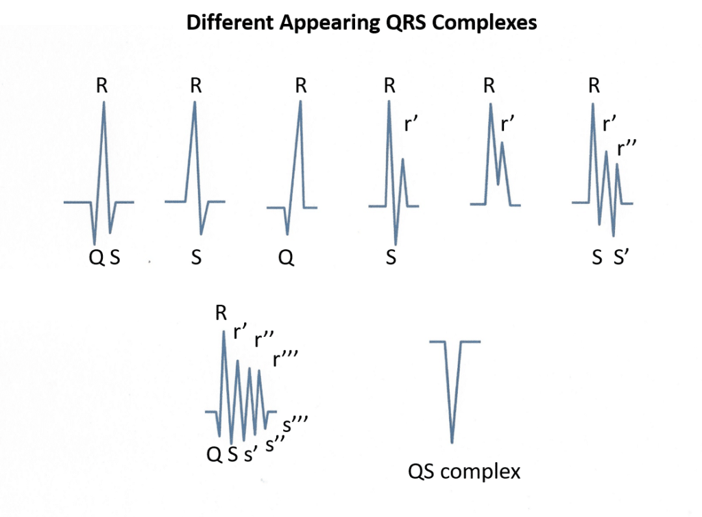 What Is An RSR Prime rSR Pattern On An ECG Executive What Is An RSR Prime rSR Pattern On An ECG Executive