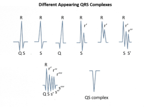 Executive Electrocardiogram Education