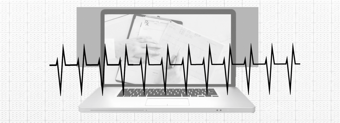 What Is An rSR Prime (rSR') Pattern On An ECG? | Executive ...