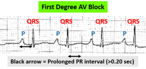Executive Electrocardiogram Education
