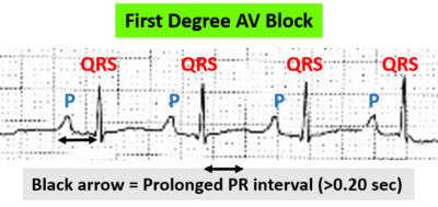 Executive Electrocardiogram Education