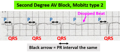 Executive Electrocardiogram Education