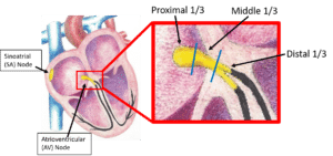 Executive Electrocardiogram Education
