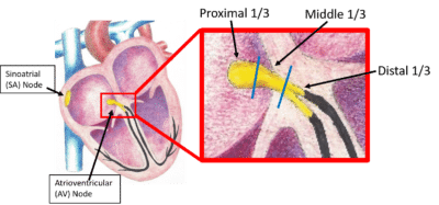 Executive Electrocardiogram Education