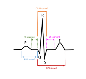 Executive Electrocardiogram Education