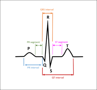 How To Read An ECG: The ECGEDU Approach To Reading EKGs