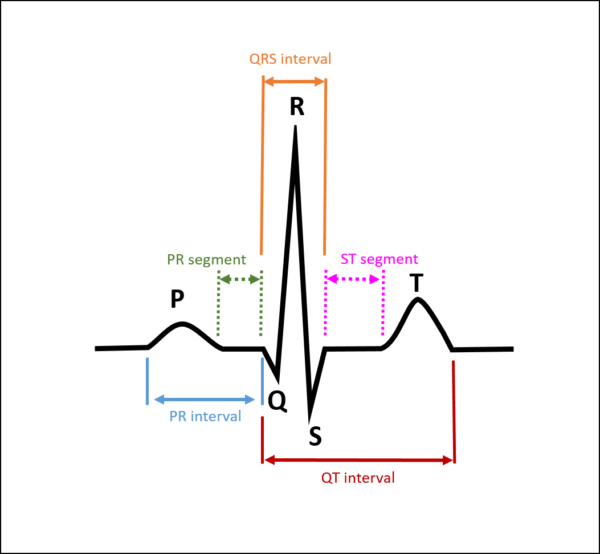 How To Read An ECG: The ECGEDU Approach To Reading EKGs