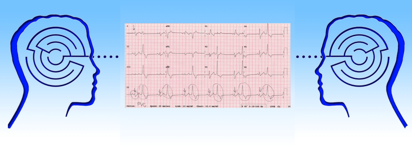 Defining, Deducing, & Diagnosing With ECGs | ECGEDU.com