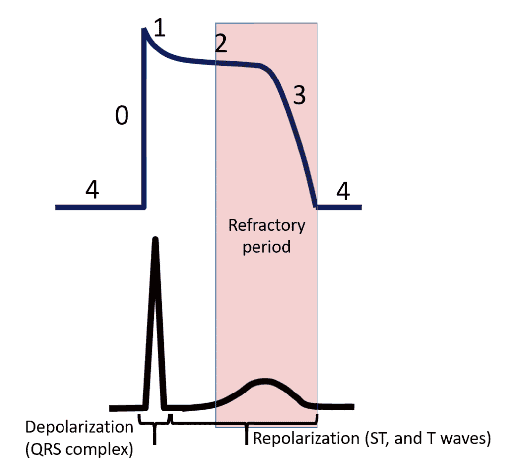 R on T Premature Ventricular Complexes (PVC) Simplified | ECGEDU.com